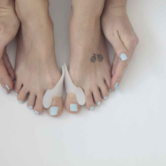 Unlocking Bunion Relief: Causes and Effective Treatments