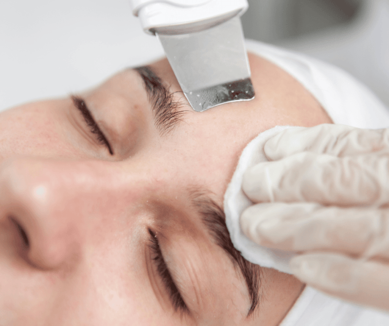 Facial Extractions 101: Your Guide to Radiant Skin and Aftercare