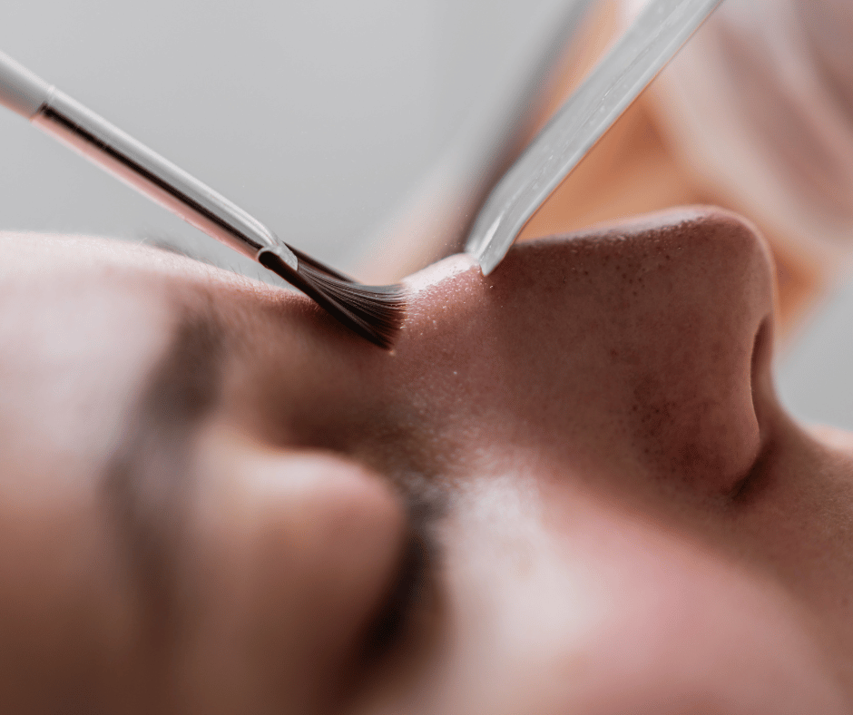 Facial Extractions 101: Your Guide to Radiant Skin and Aftercare